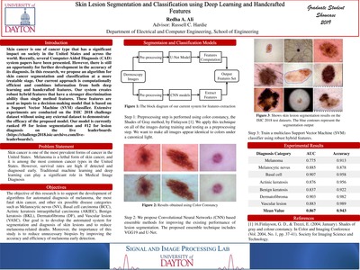 "Skin Lesion Segmentation and Classification using Deep Learning and Ha"