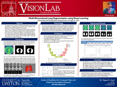 "Multi-Dimensional Lung Segmentation using Deep Learning"